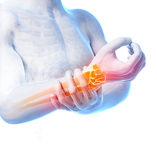 Elbow, Hand and Wrist Pain | Chiropractor in Delmar, New York | Dr ...