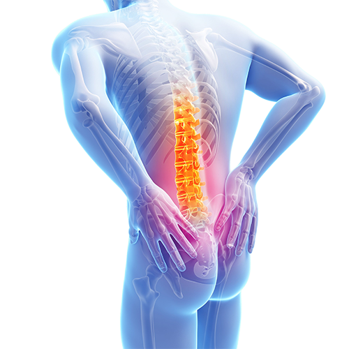 Lower Back Pain | Chiropractor in Red Wing, MN | Red Wing Chiropractic Clinic