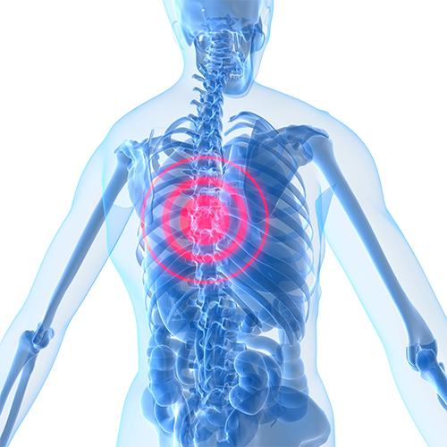 Mid Back Pain | Chiropractor in Red Wing, MN | Red Wing Chiropractic Clinic