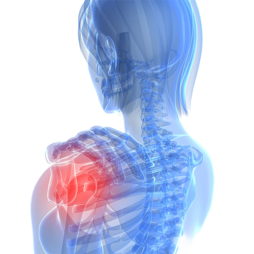 Shoulder and Clavicle Pain | Chiropractor in Red Wing, MN | Red Wing ...