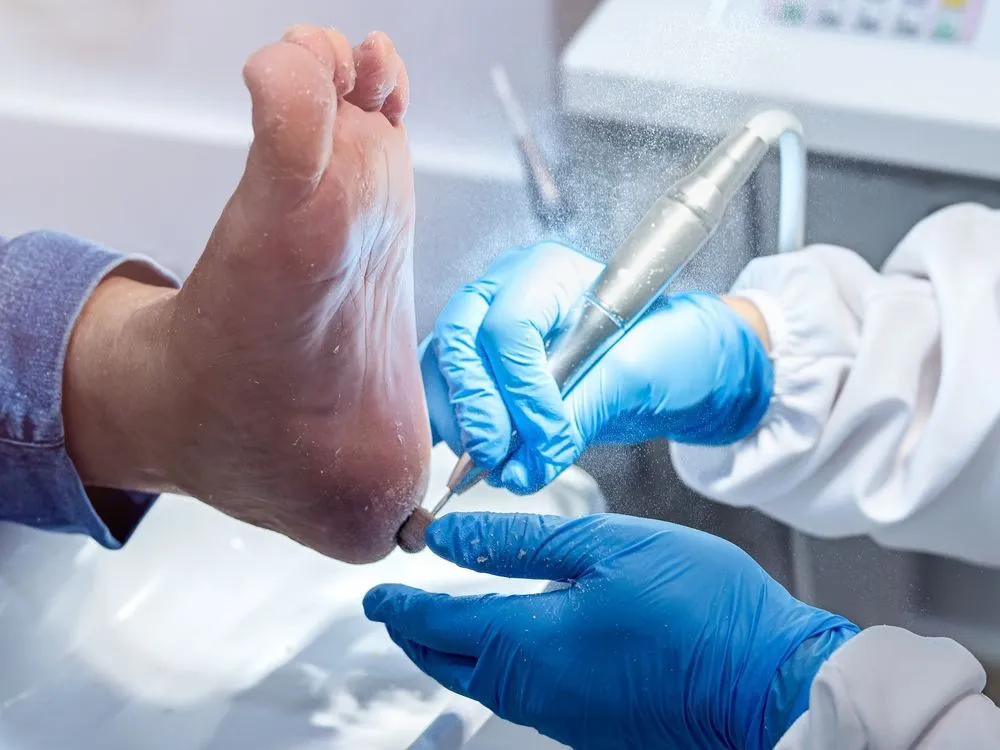 Mobile Podiatry Services | Podiatrist In Pleasanton, CA | East Bay Foot ...