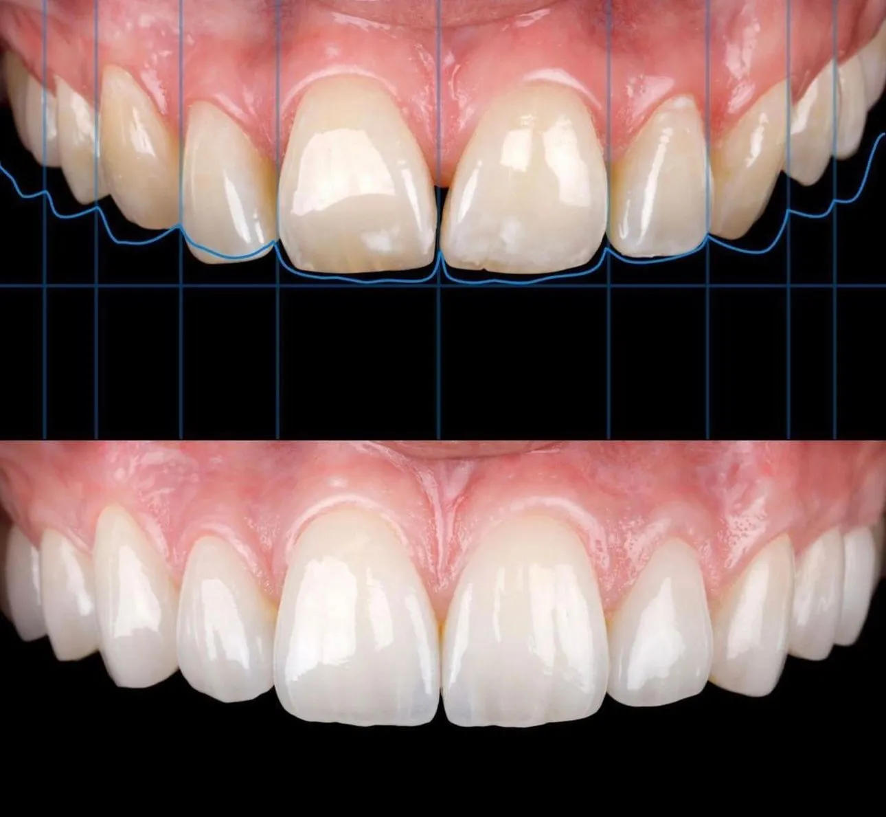 Iconic smiles | Gallery in Bellerose