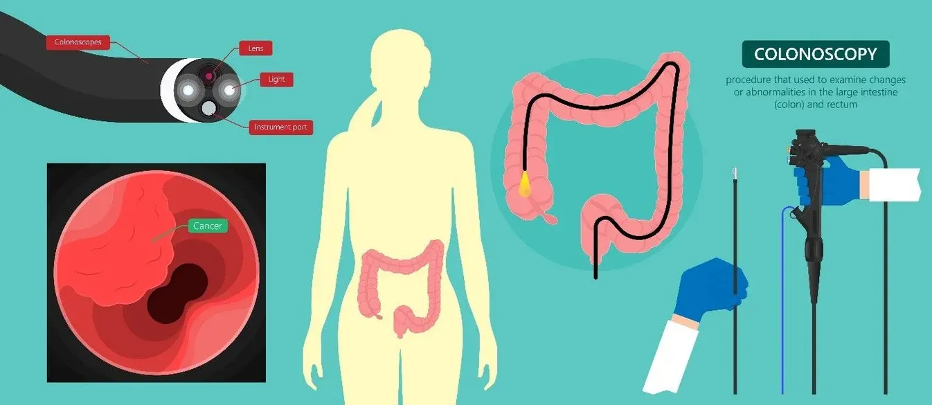Endoscopic Mucosal Resection (EMR) | Gastroenterologist in Forest Hills ...