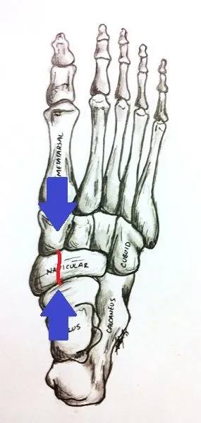 Navicular - Robert Sheinberg, DPM | Weston, FL Podiatrist