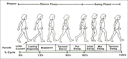 Gait Disturbance - Robert Sheinberg, DPM | Weston, FL Podiatrist