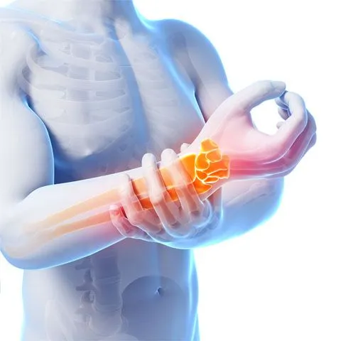 Elbow, Hand, and Wrist | Chiropractor in Lubbock, TX | Lubbock ...