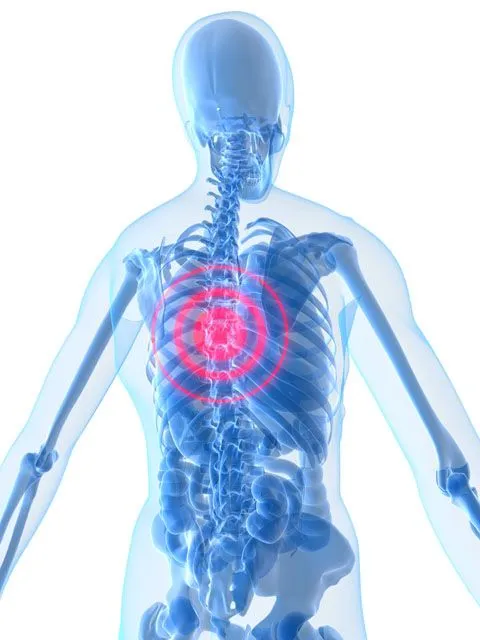 Mid-Back | Chiropractor in Buford, GA | Spine Pros Buford