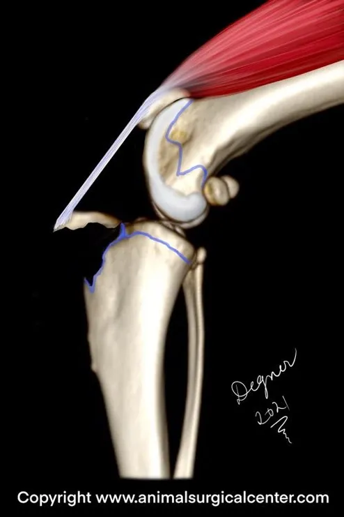 supinator crest avulsion
