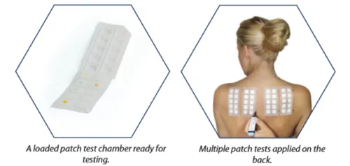 Patch Testing - Dermatologist in Holmdel, Middletown, & Tinton Falls, NJ