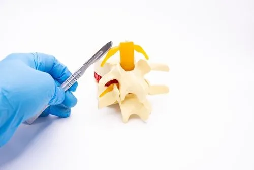 Peripheral Nerve Surgery | Neurosurgeon in Redlands, CA | Cortez ...