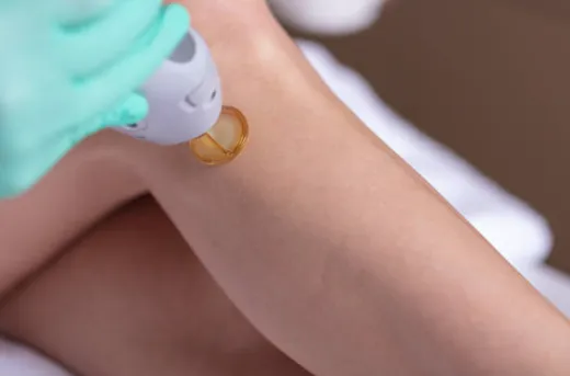 Laser Hair Reduction - Aspire Dermatology | Dermatologist in Cumberland, RI