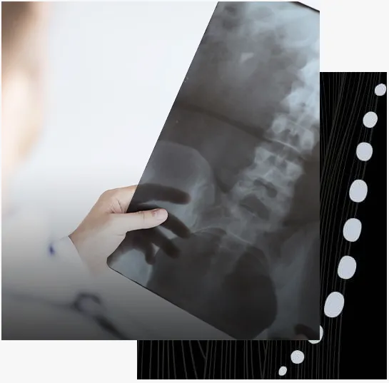 Digital Motion X-ray & Video Fluoroscopy in Summerville | Chiropractor ...
