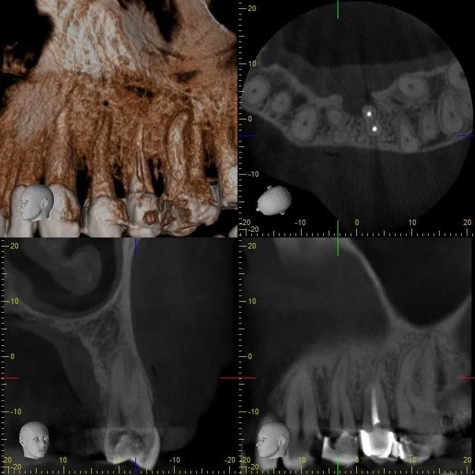 Root Canal Wizards, New York, New York Dentist - Dr. Amy Dukoff