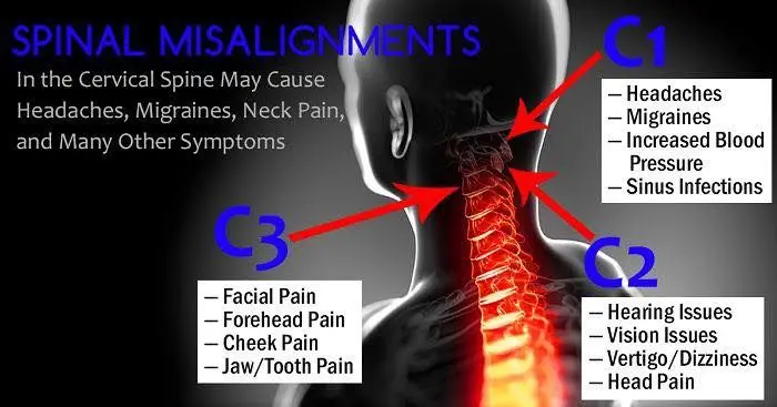 cervical spine issues